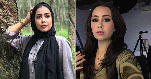 Kena Malapraktik! 10 Potret Menawan Rency Milano, Kakak Elma Thea | IDN ...