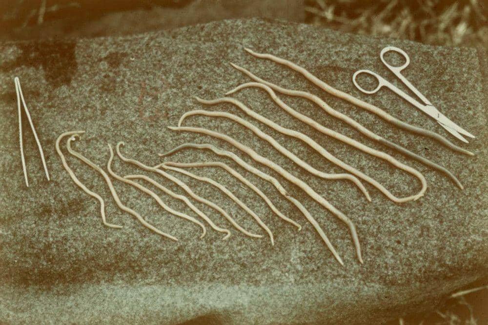 5 Fakta Raya, Anak Sukabumi yang Viral Meninggal dengan Tubuh Penuh Cacing | IDN Times