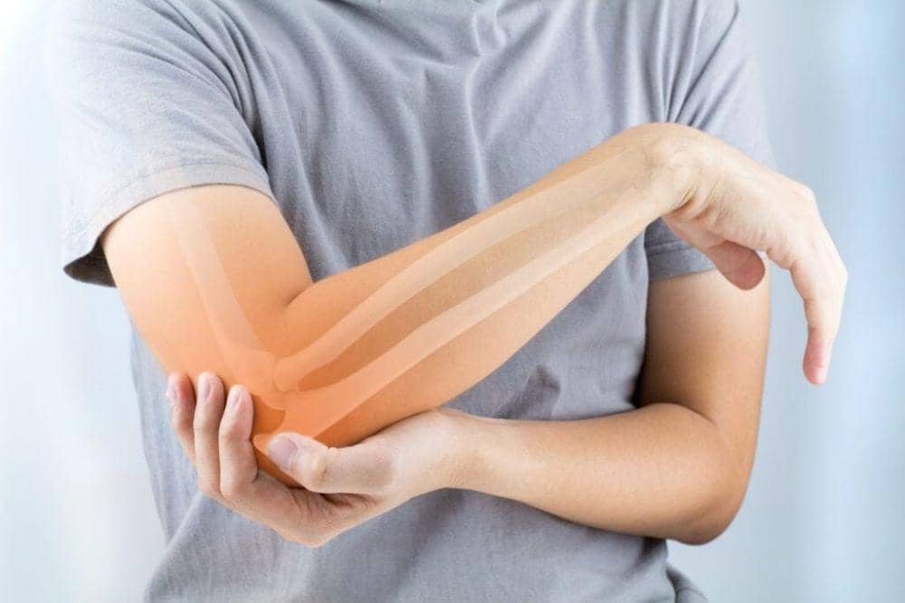 Tendinitis: Penyebab, Gejala, Jenis, Diagnosis, Pengobatan | IDN Times