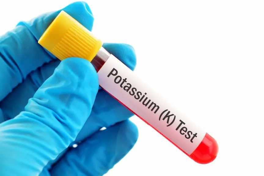 Hiperkalemia: Penyebab, Gejala, Diagnosis, dan Pengobatan | IDN Times