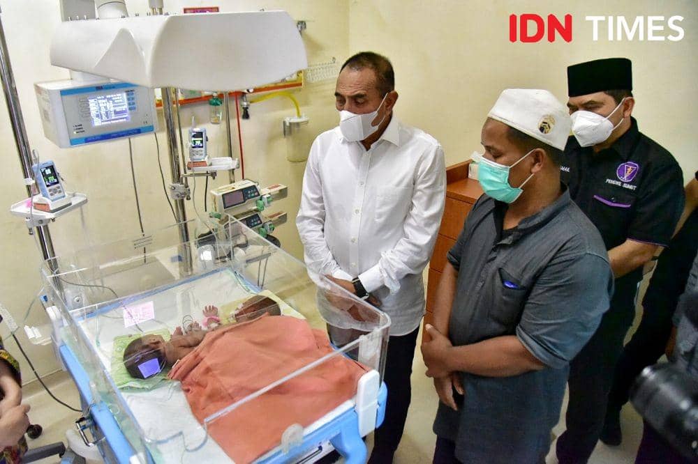 Operasi Bayi Kembar Dempet Asal Asahan Dipertimbangkan | IDN Times Sumut