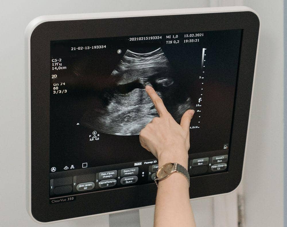 USG: Tujuan, Jenis, Prosedur, Hasil, Keterbatasan | IDN Times