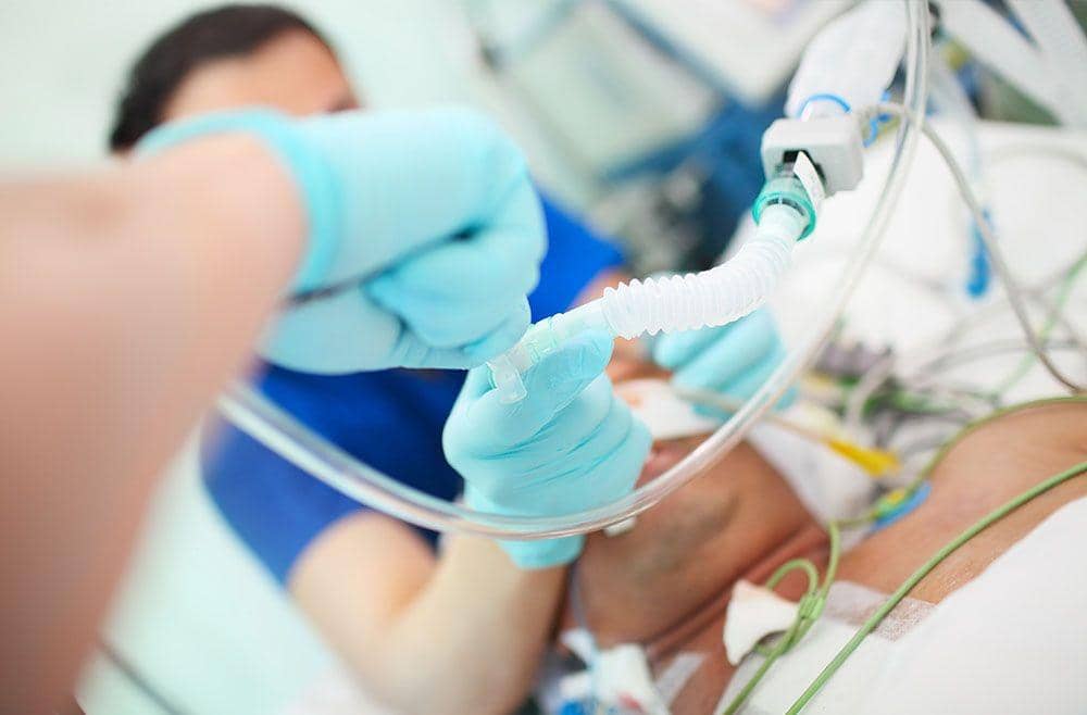 Intubasi: Jenis, Tujuan, Prosedur, Risiko | IDN Times