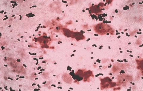 Infeksi Streptococcus: Gejala, Pengobatan, Komplikasi | IDN Times