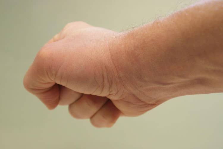 Perbedaan Pembuluh Darah Arteri dan Vena, Jangan Sampai Keli | IDN Times