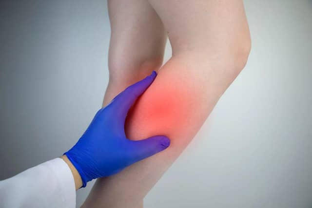 Phlebitis: Penyebab, Gejala, Diagnosis, Pengobatan | IDN Times