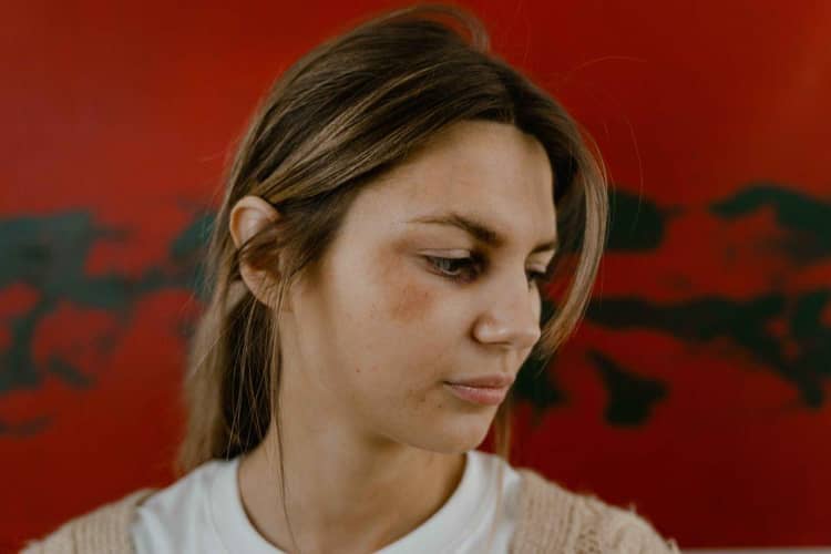 16 Penyebab Memar Timbul di Tubuh | IDN Times