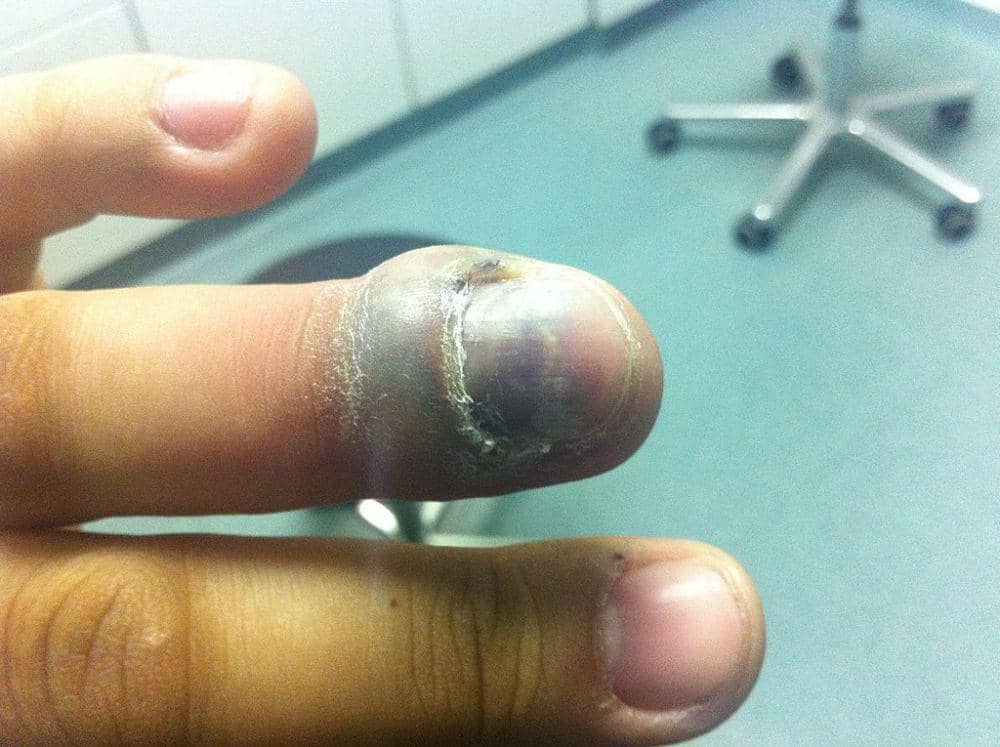 15 Masalah Kuku yang Harus Diperiksakan ke Dokter | IDN Times