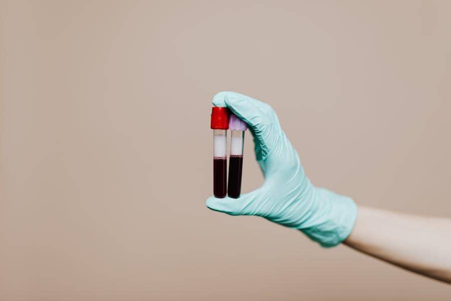 Berapa HB Normal untuk Wanita? Berikut Ketentuannya | IDN Times