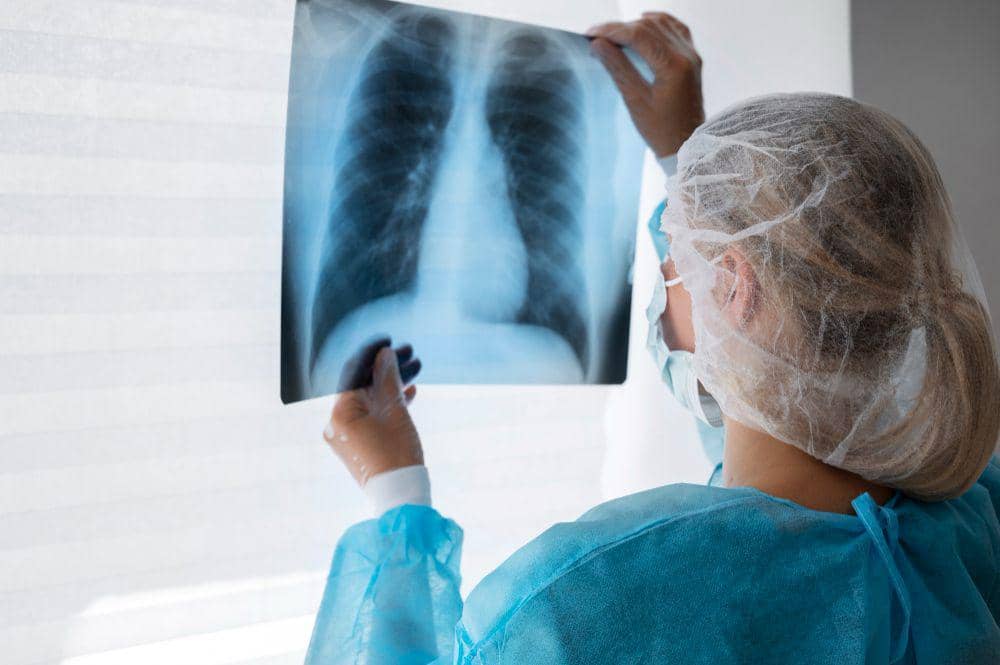 Infeksi Paru-Paru: Penyebab, Gejala, Diagnosis, Pengobatan | IDN Times