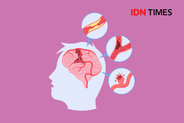 Apa Itu Obat Poppers? Perangsang yang Disita Bareskrim | IDN Times