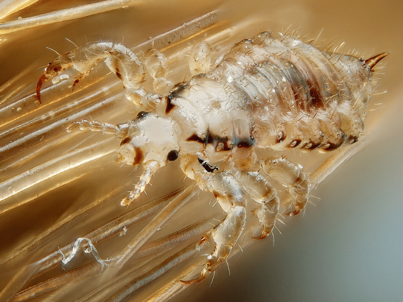 5 Cara Menghilangkan Telur Kutu Rambut dalam 1 Hari | IDN Times