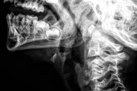 6 Macam Sendi Gerak pada Manusia yang Perlu Kamu Tahu! | IDN Times Jateng