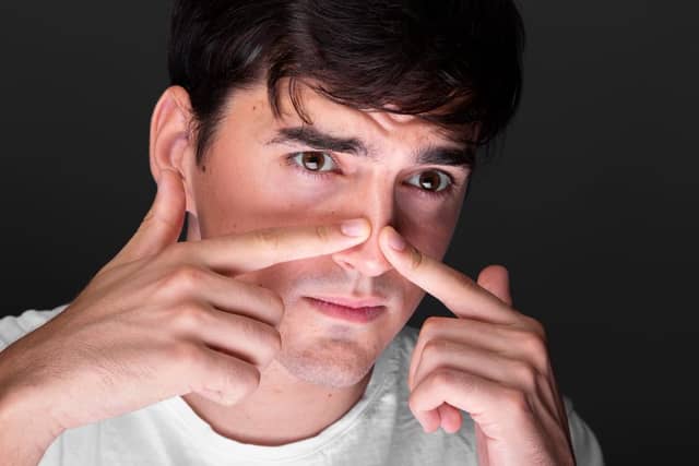 5 Cara Usir Jerawat di Hidung biar Muka Kelihatan Bersih | IDN Times