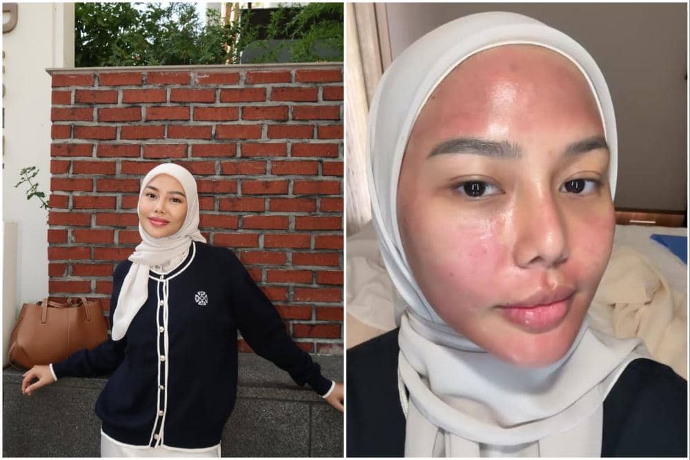 Dara Arafah Jalani Treatment Wajah di Korea Selatan | IDN Times