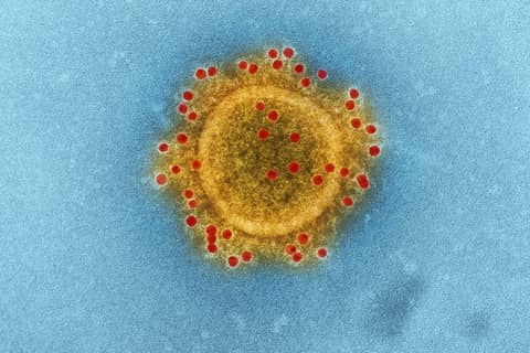 7 Ciri Virus yang Sering Kita Abaikan, Kenali agar Terhindar! | IDN Times