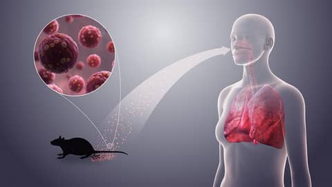 Hantavirus Pulmonary Syndrome: Penyebab, Gejala, Pengobatan | IDN Times